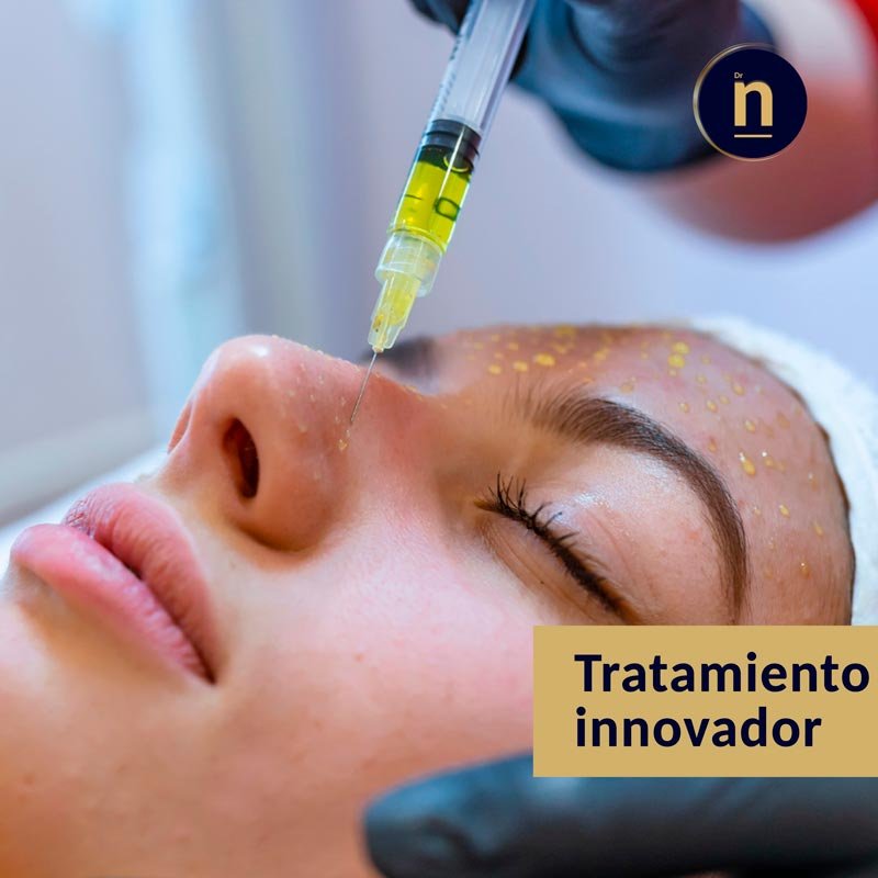 Plasma rico en plaquetas (PRP) - Doctor Nelson Cáceres